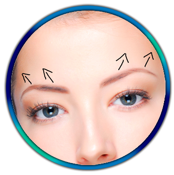 PEXIA DE CEJAS – Dr. Soto Montenegro